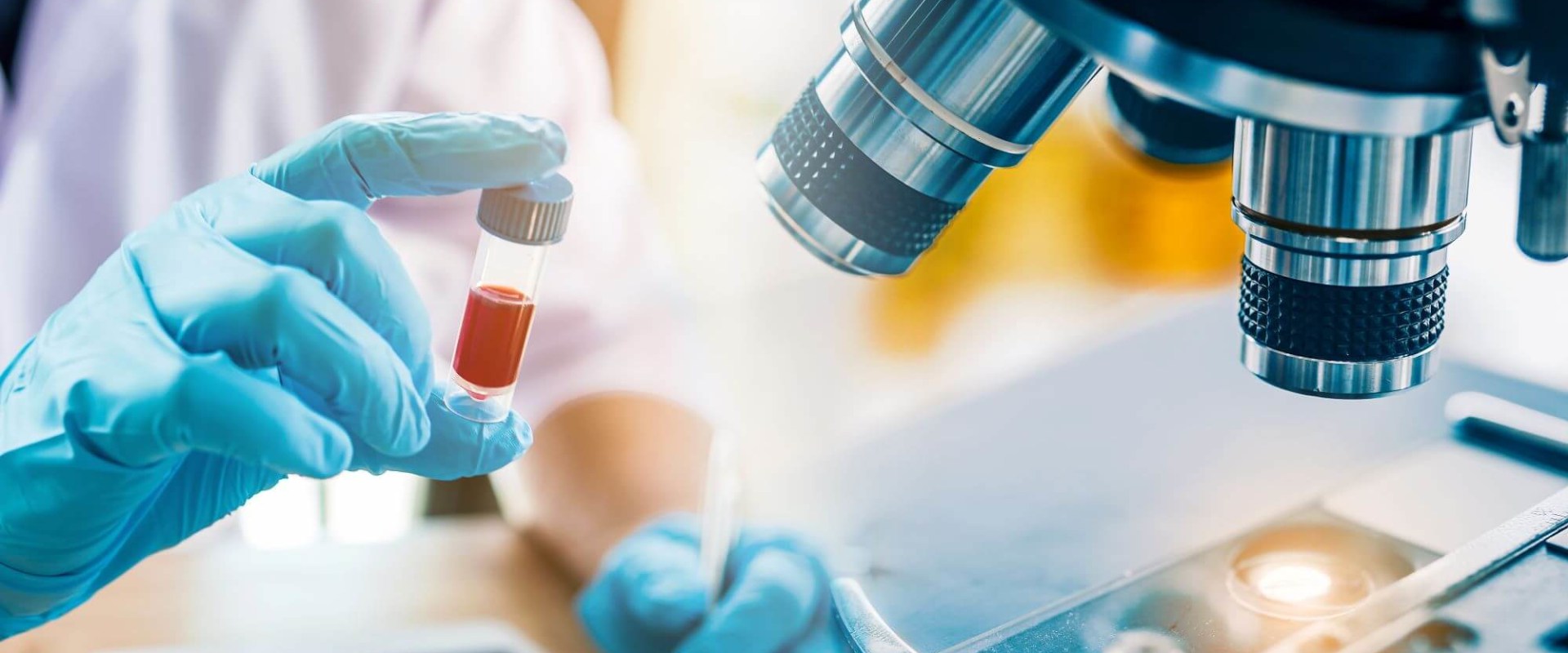 Everything You Need to Know About Glycated Hemoglobin Tests (HbA1c)