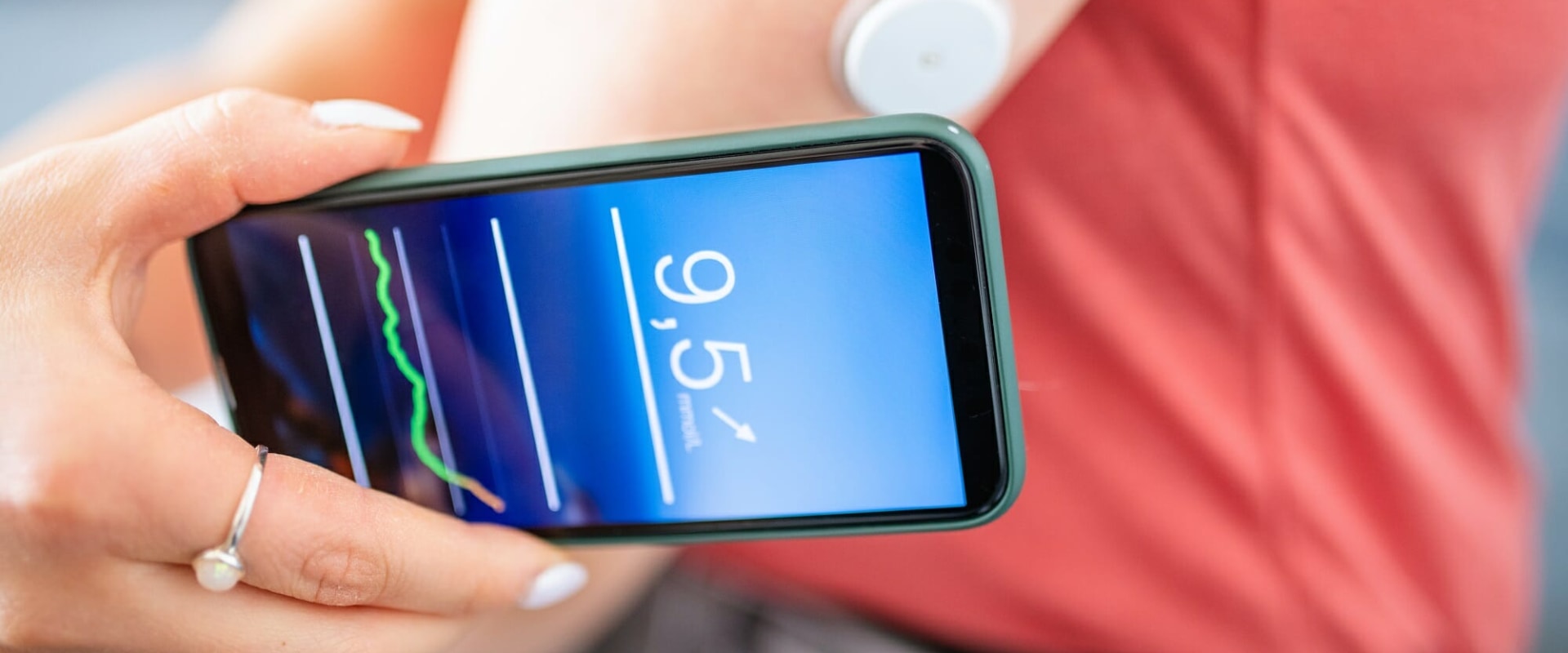 Types of Smartphone-based Glucose Monitoring Systems