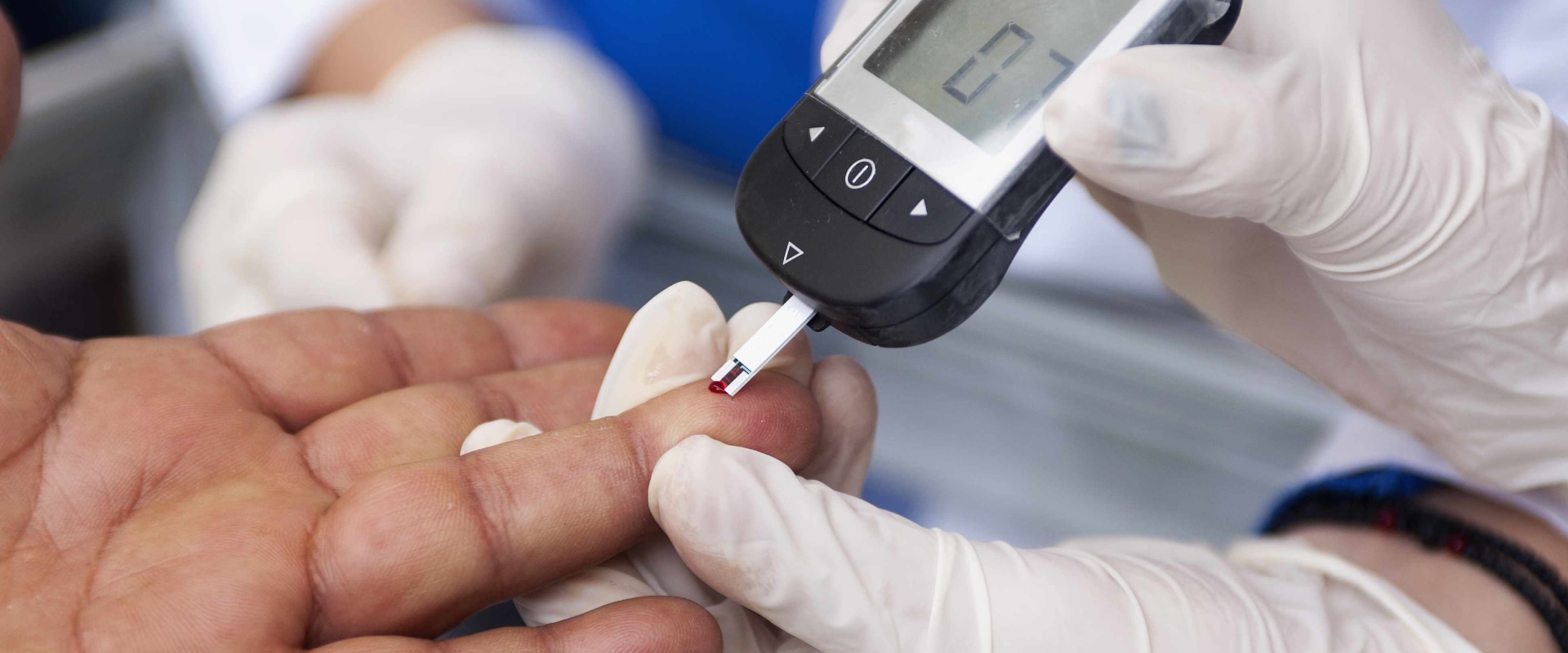 Random Plasma Glucose Test: Everything You Need to Know